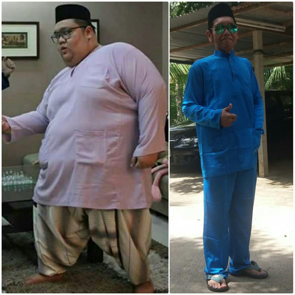 30 Tahun Obesiti, Lelaki 183kg Kini Tinggal 99kg Dengan Jaga Pemakanan ...